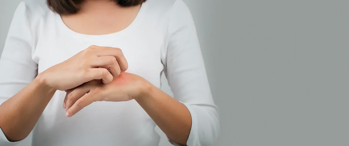 Dishidrosis de manos y pies (eccema Dishidrótico): causas y tratamiento ...