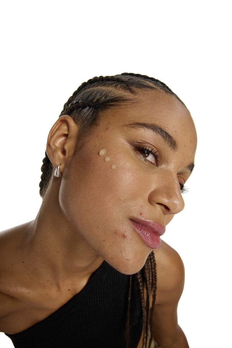 Boutons sur le menton: comment les traiter ? | Eucerin BE