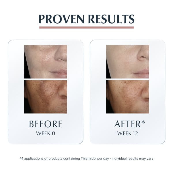 Hyperpigmentation Dual Serum | Reduce Pigment Spots | Eucerin