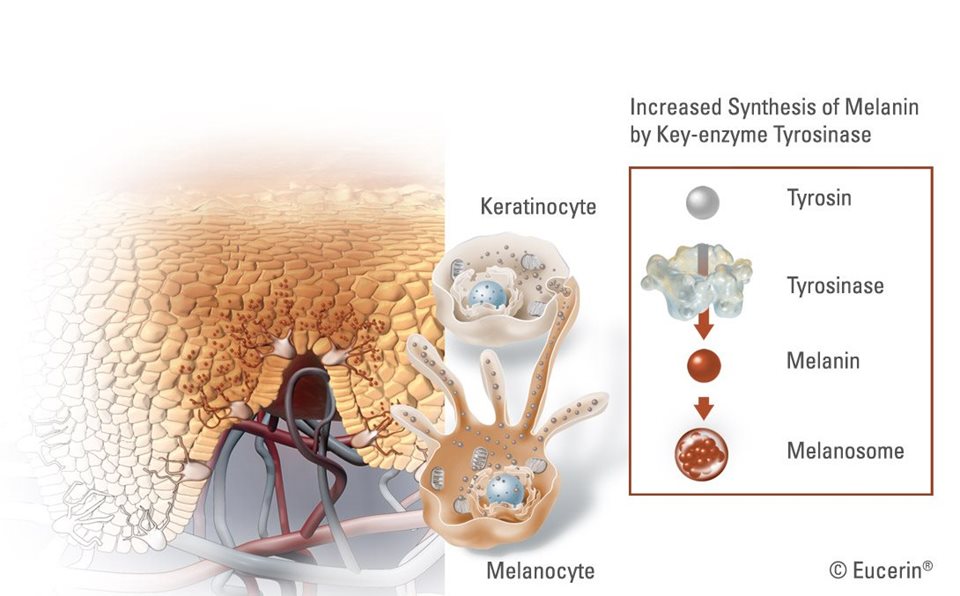 Different Types of Skin by Ethnic Groups | Eucerin