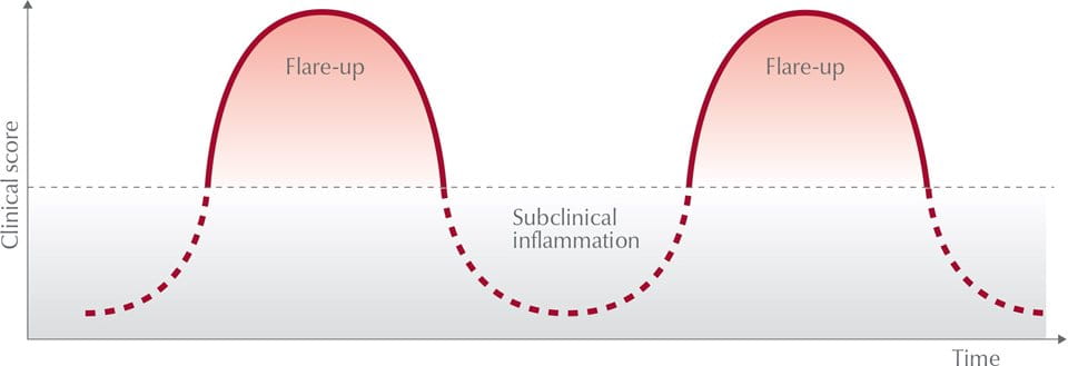 Atopic Dermatitis flare-up| Atopic skin | Eucerin