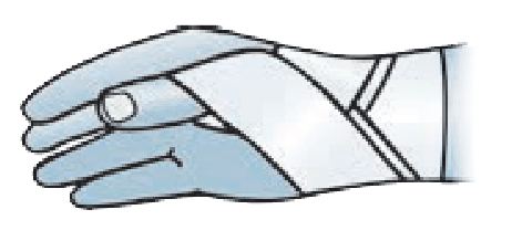 Effective Thumb Strapping Techniques for Injury Support | Elastoplast