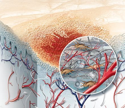 Phases of Wound Healing | Wound Healing & Care | Elastoplast
