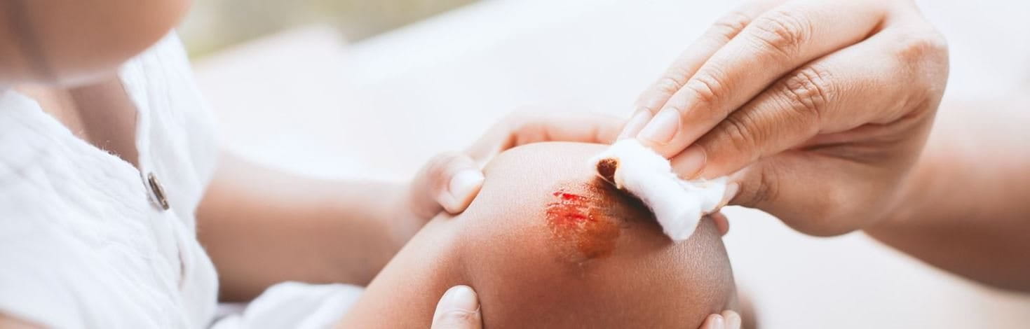 Wundarten erkennen und richtig einschätzen | Hansaplast