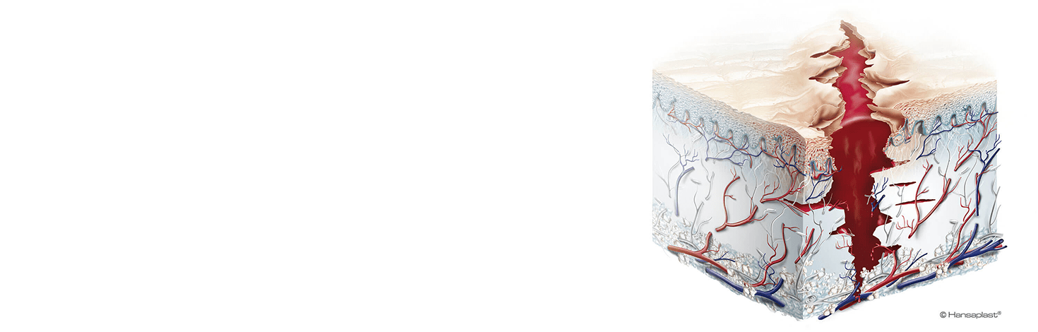 Perbedaan Luka Lecet dan Gores dan Bagaimana Perawatannya